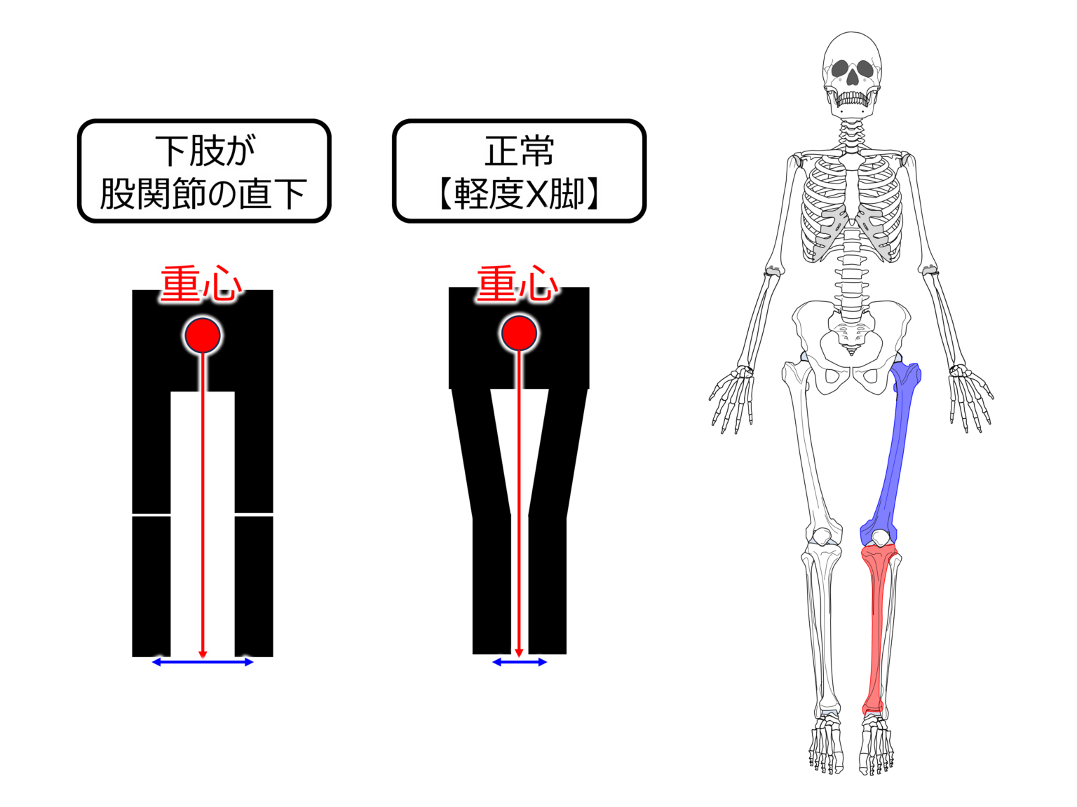 膝関節の生理的外反 | 整体＆パーソナルトレーニングスタジオ/TCLab