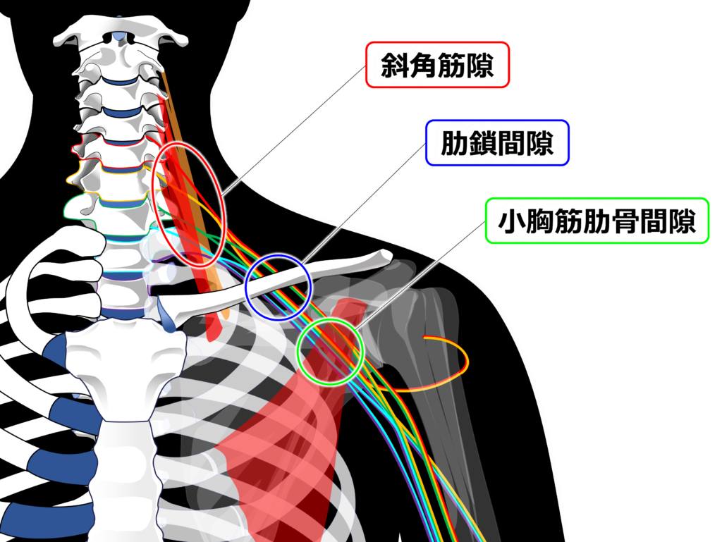 胸郭出口症候群【TOS：Thoracic Outlet Syndrome】 | 整体＆パーソナルトレーニングスタジオ/TCLab